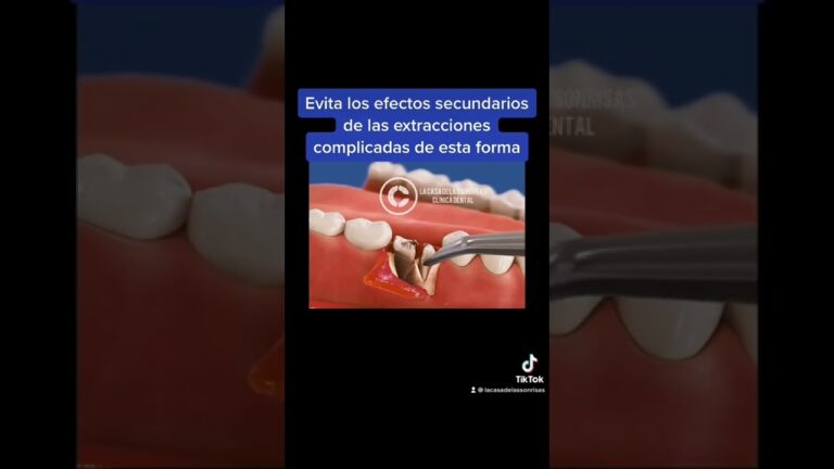 Cómo Tratar una Muela Rota al Ras de la Encía: Causas, Síntomas y ...