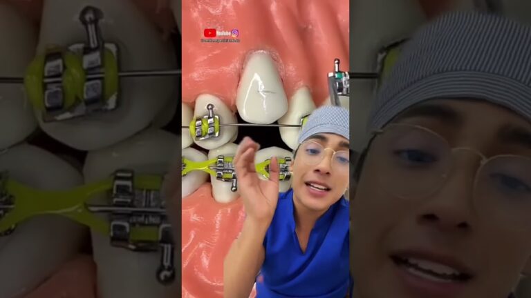 ¿Cómo se llama el doctor que pone brackets? Todo lo que necesitas saber ...